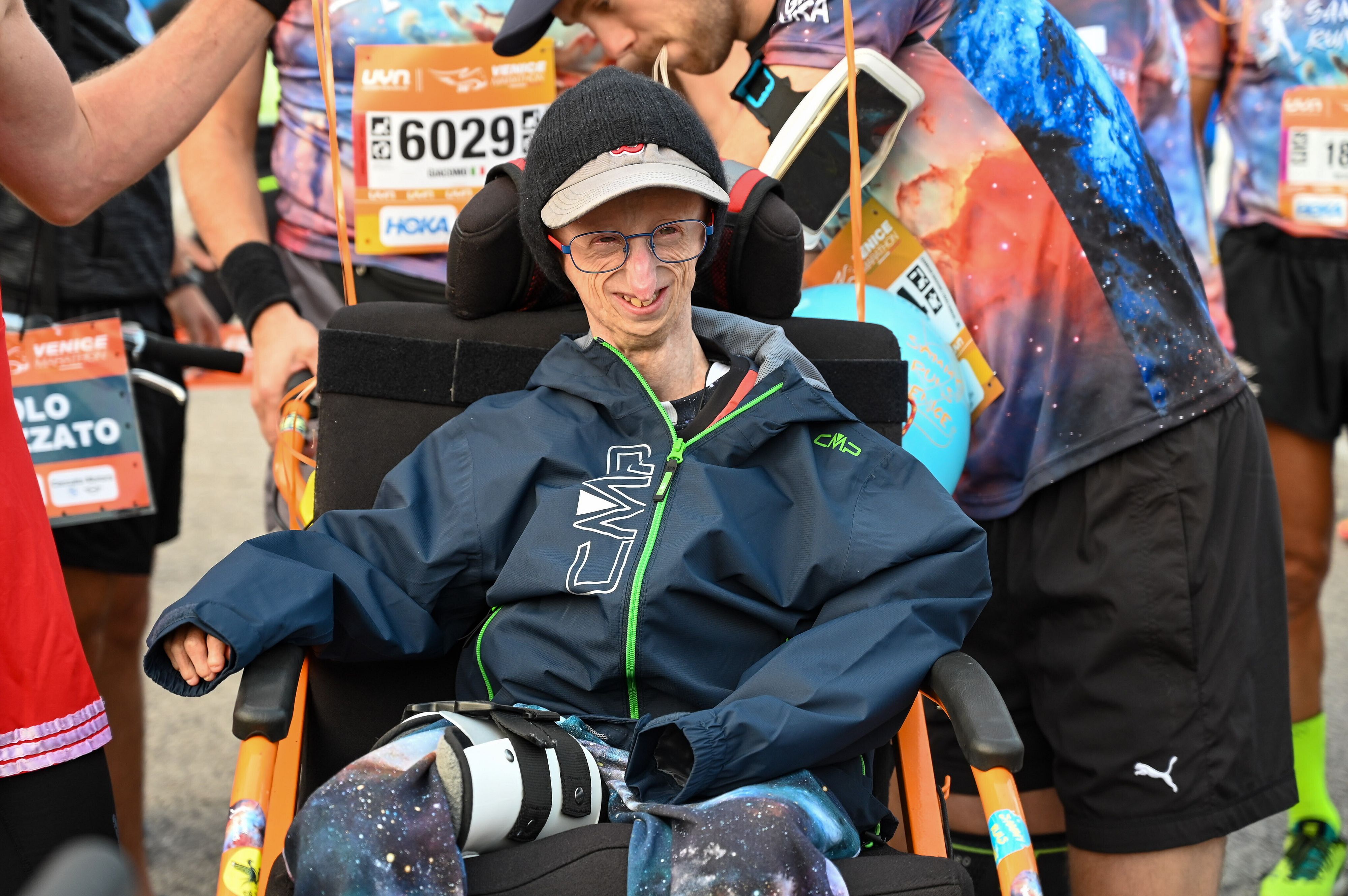 È morto Sammy Basso, ha fatto conoscere all'Italia la progeria