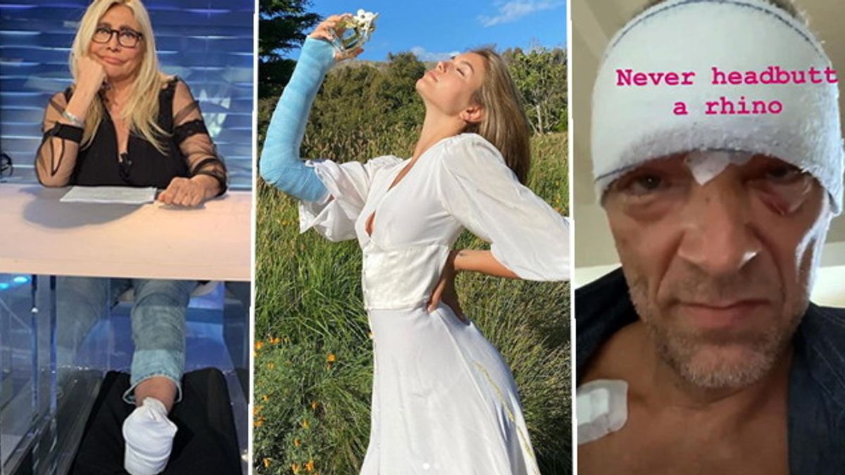 Ossa rotte e fasciature, i vip infortunati durante il lockdown - Tgcom24