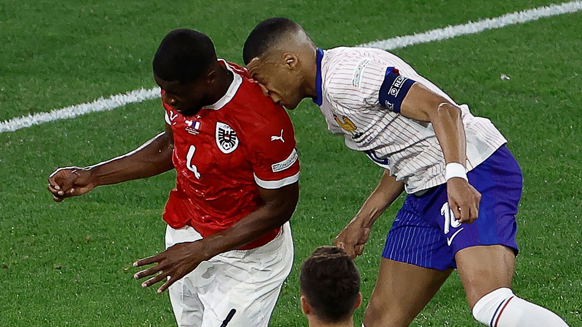 Mbappé, la Federcalcio francese conferma: naso rotto ma nessuna operazione