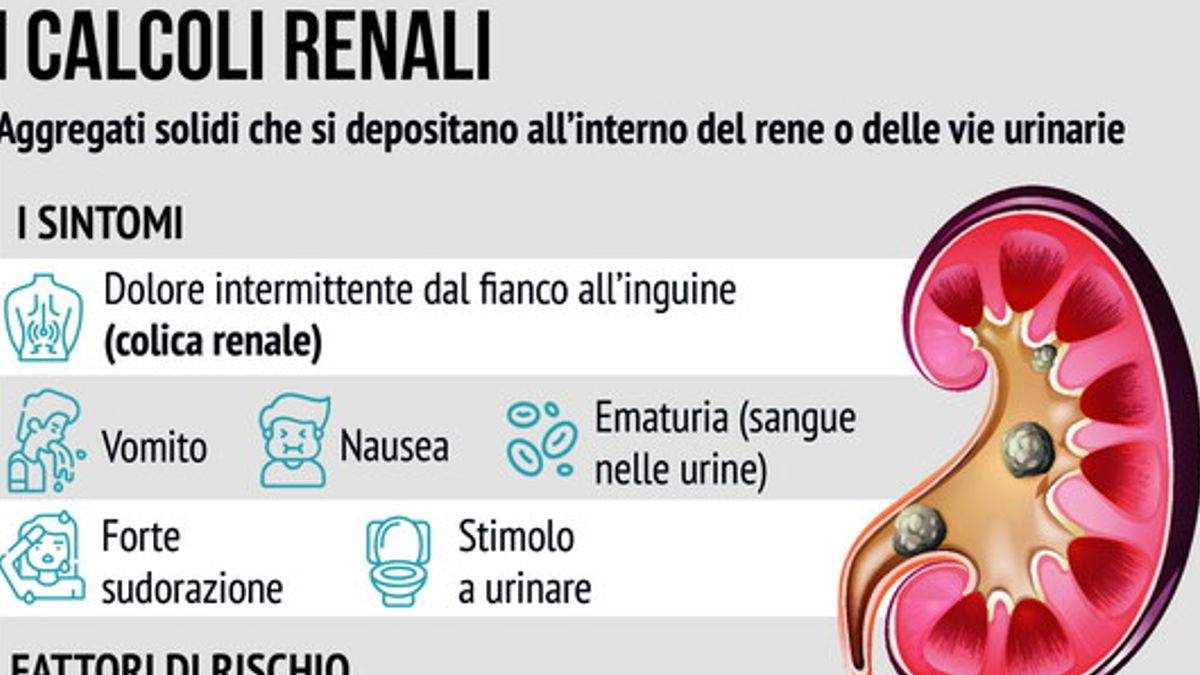 Calcoli renali: sintomi e fattori di rischio