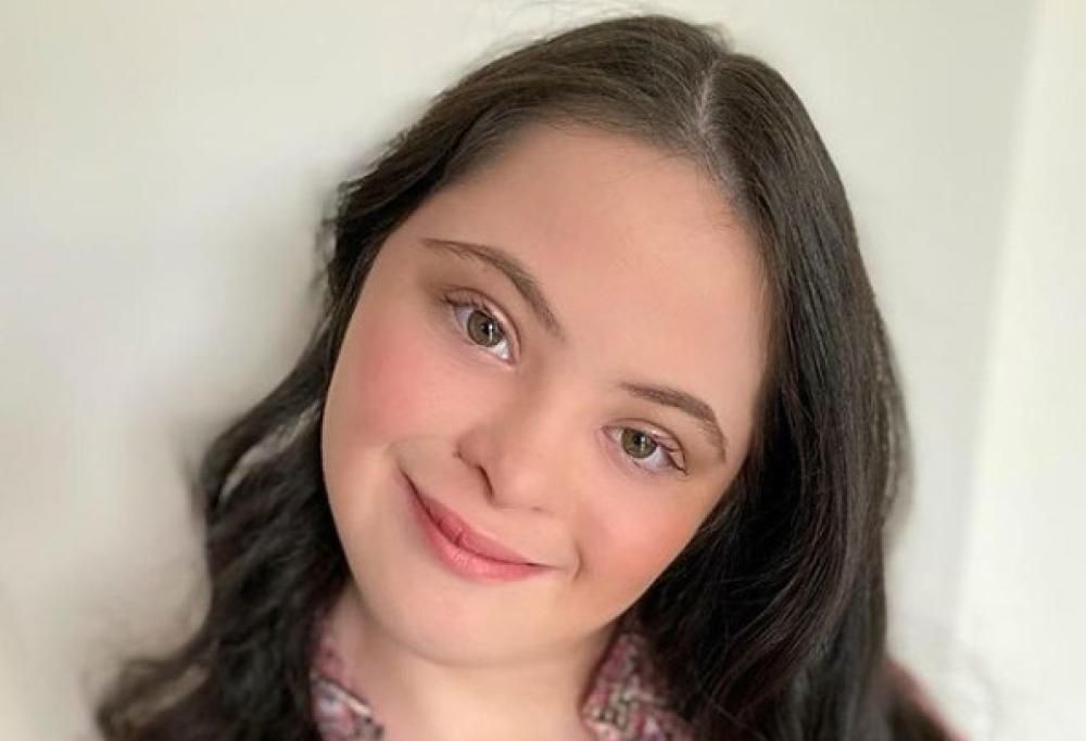 Ellie Goldstein è la prima modella con sindrome di Down a posare per ...