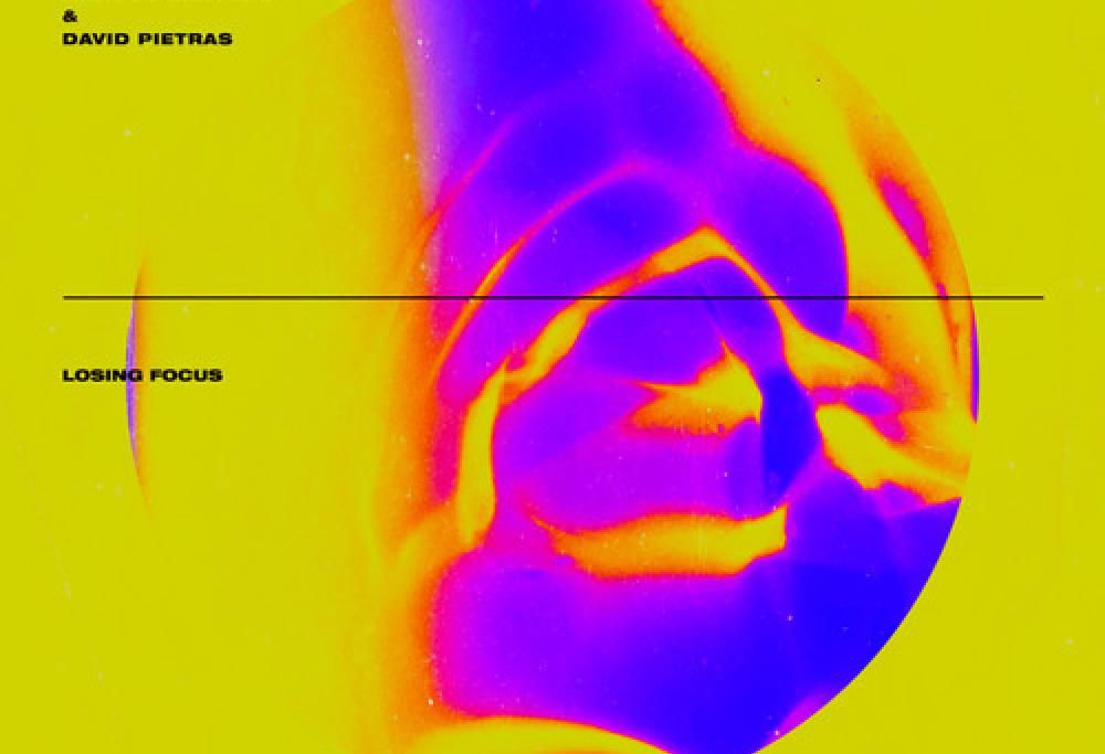 Losing Focus - Radio 105